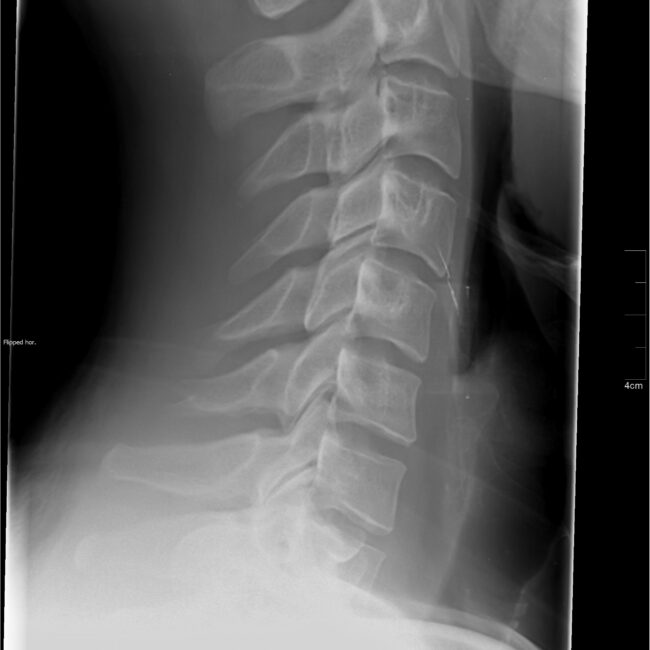 About Us – Kaplan Chiropractic